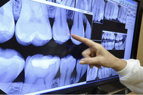 Digital X Rays - Guelphview Dental